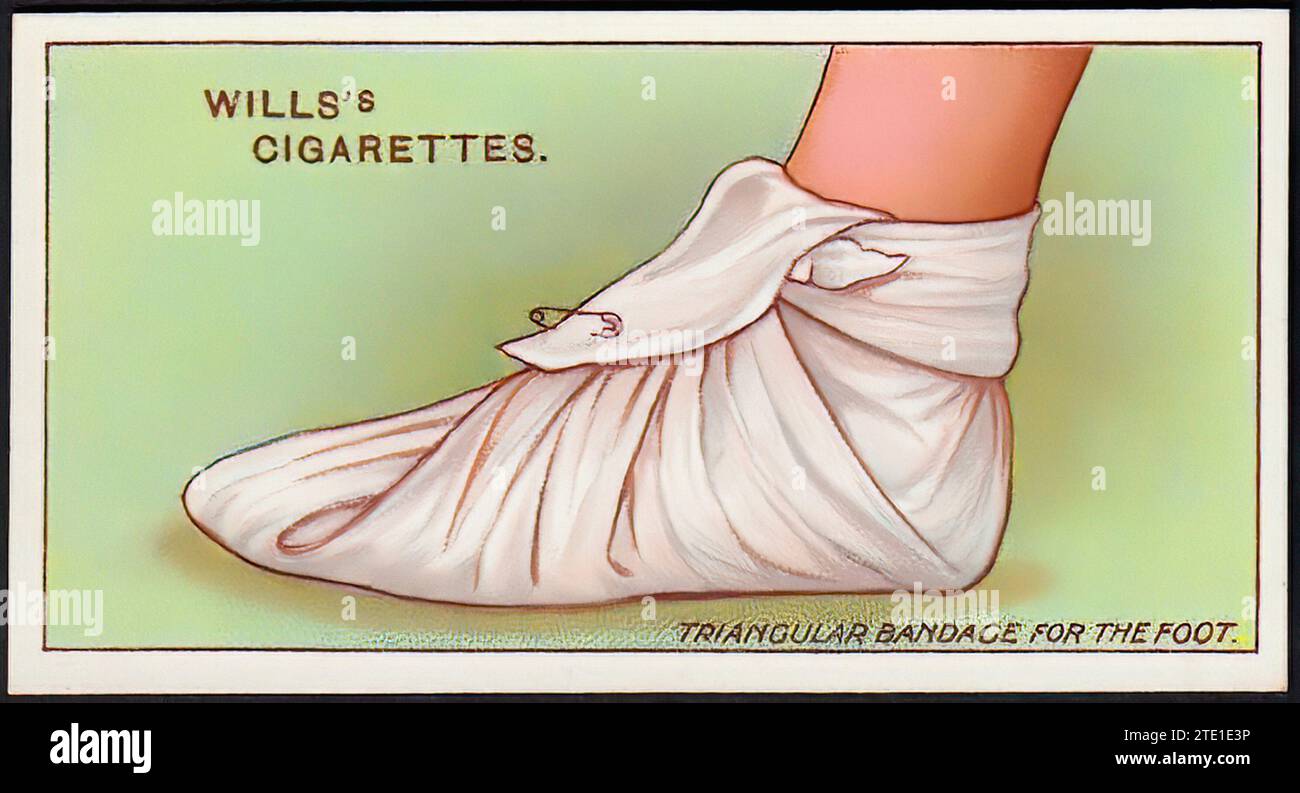 First Aid, Foot Bandage - Vintage Cigarette Card Illustration Stock ...