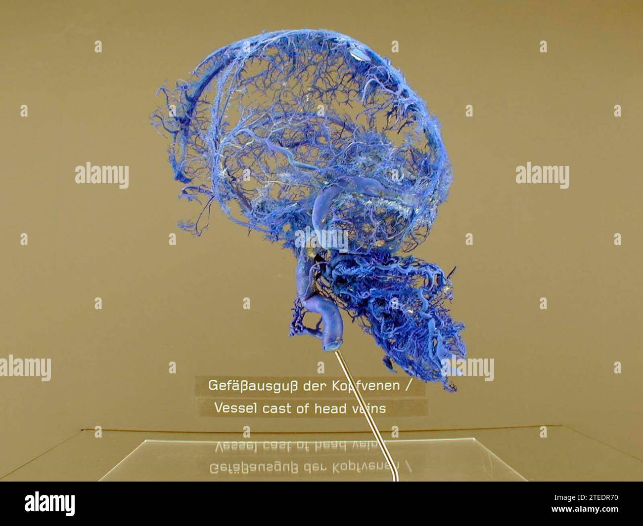 a model of the blood vessels of the human brain blood vessels of the ...