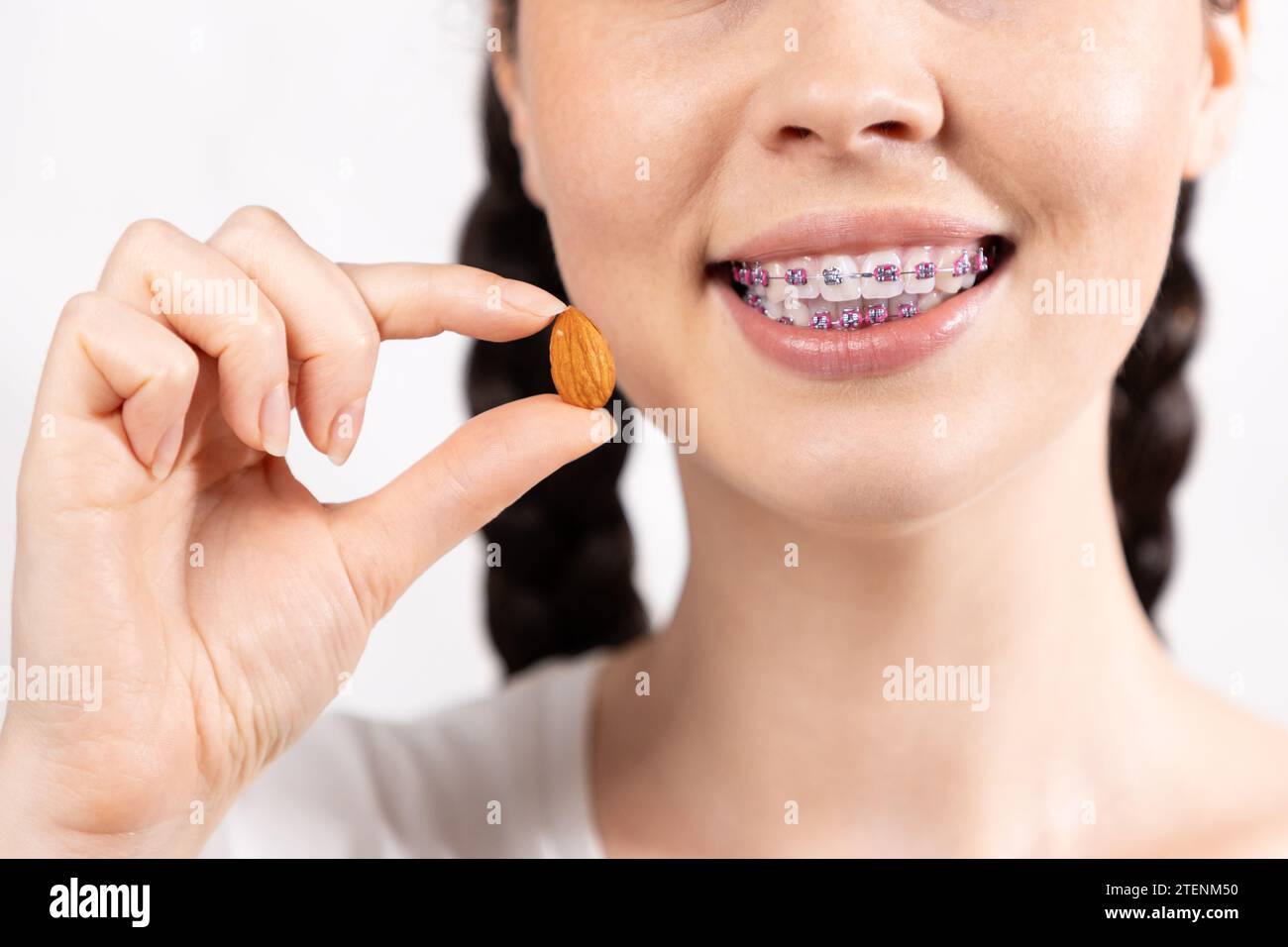 Close up of young Caucasian smiling woman with brackets show almond nut ...