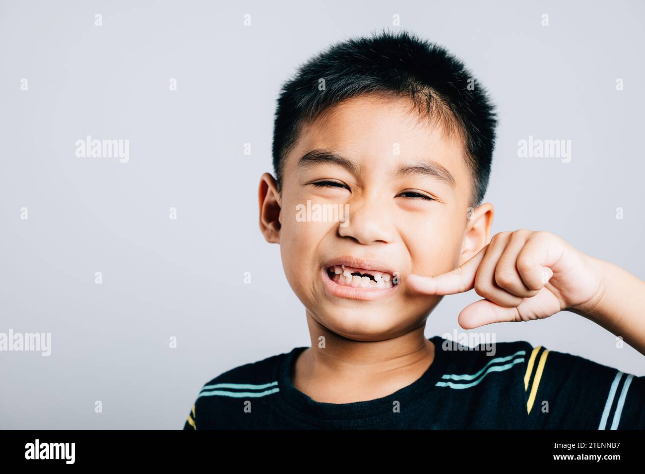 Asian boy with missing front tooth symbolizes dental health care while ...