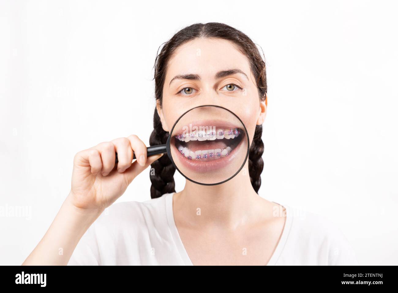 Portrait of smiling woman with braces on her teeth, magnified through ...