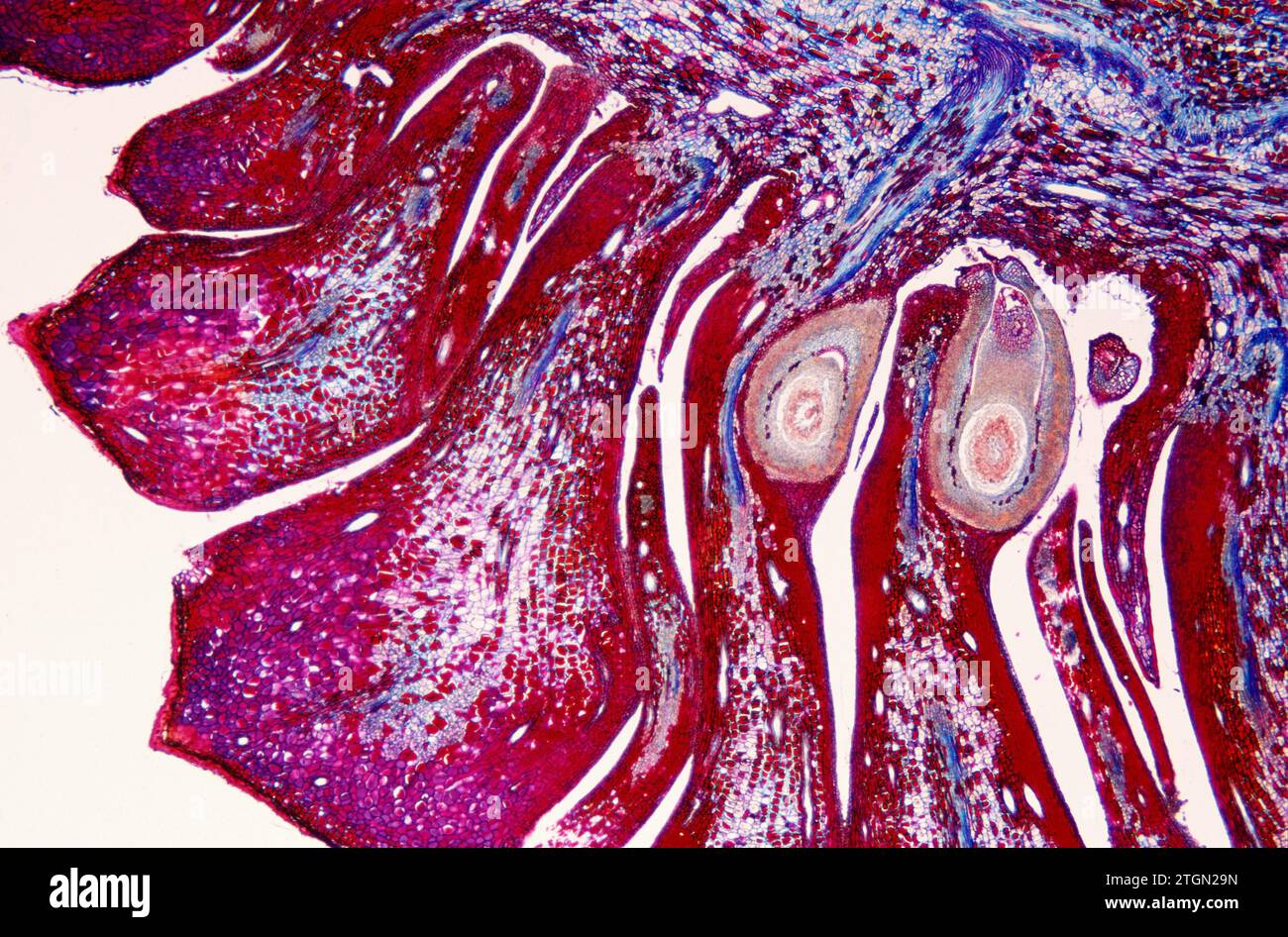 Pine female cone showing ovules. Photomicrograph Stock Photo - Alamy