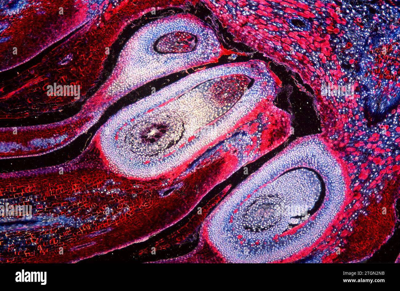 Pine female cone showing ovules. Photomicrograph Stock Photo - Alamy