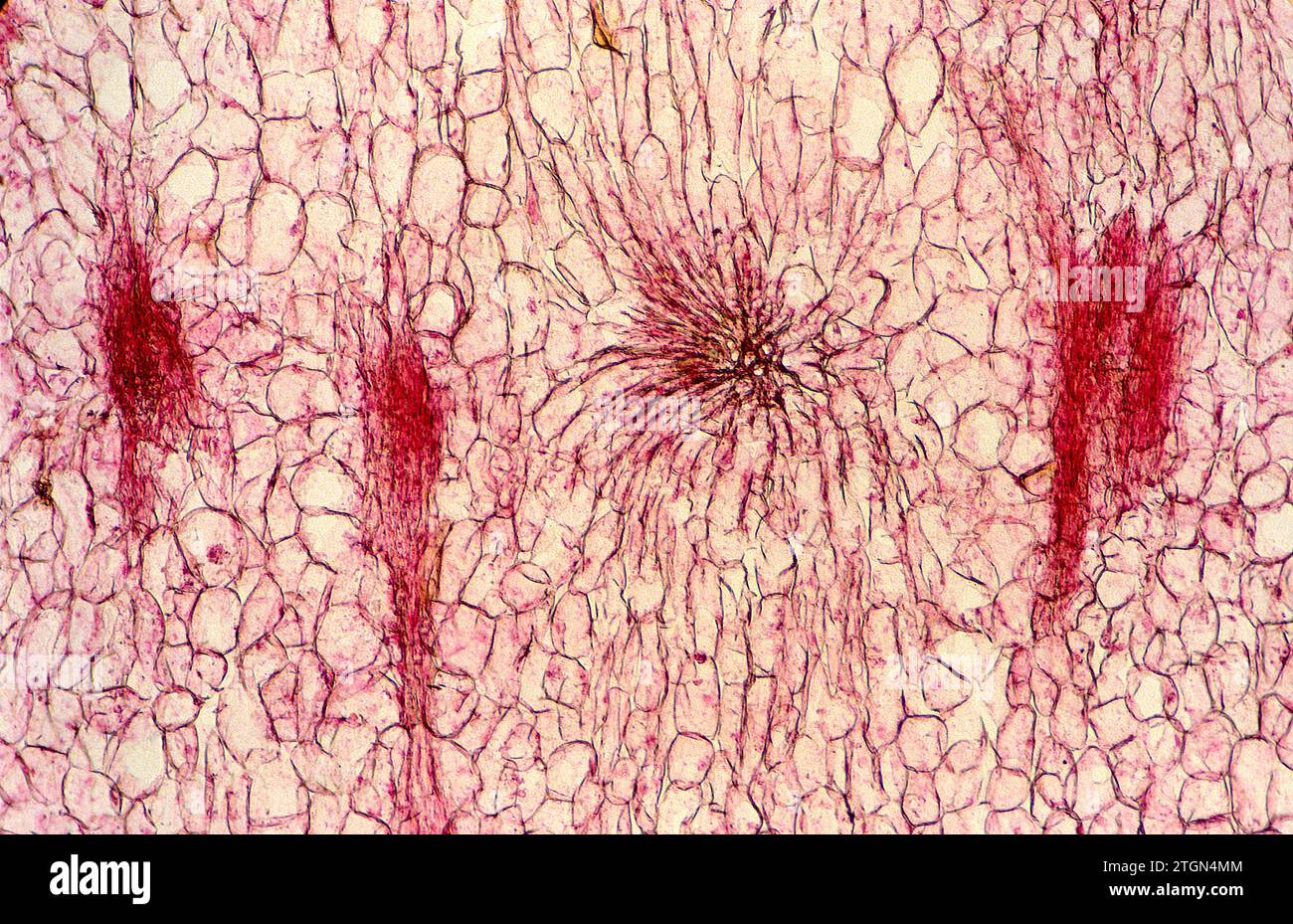 Plant lignified tissue hi-res stock photography and images - Alamy