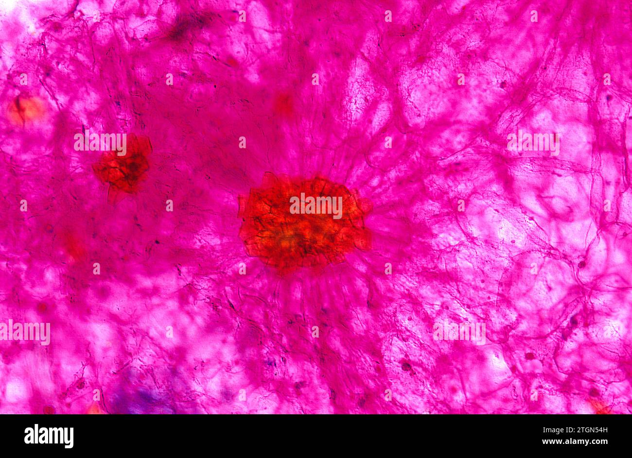 Sclereids are a kind of sclerenchyma, a support plant tissue. Pear ...