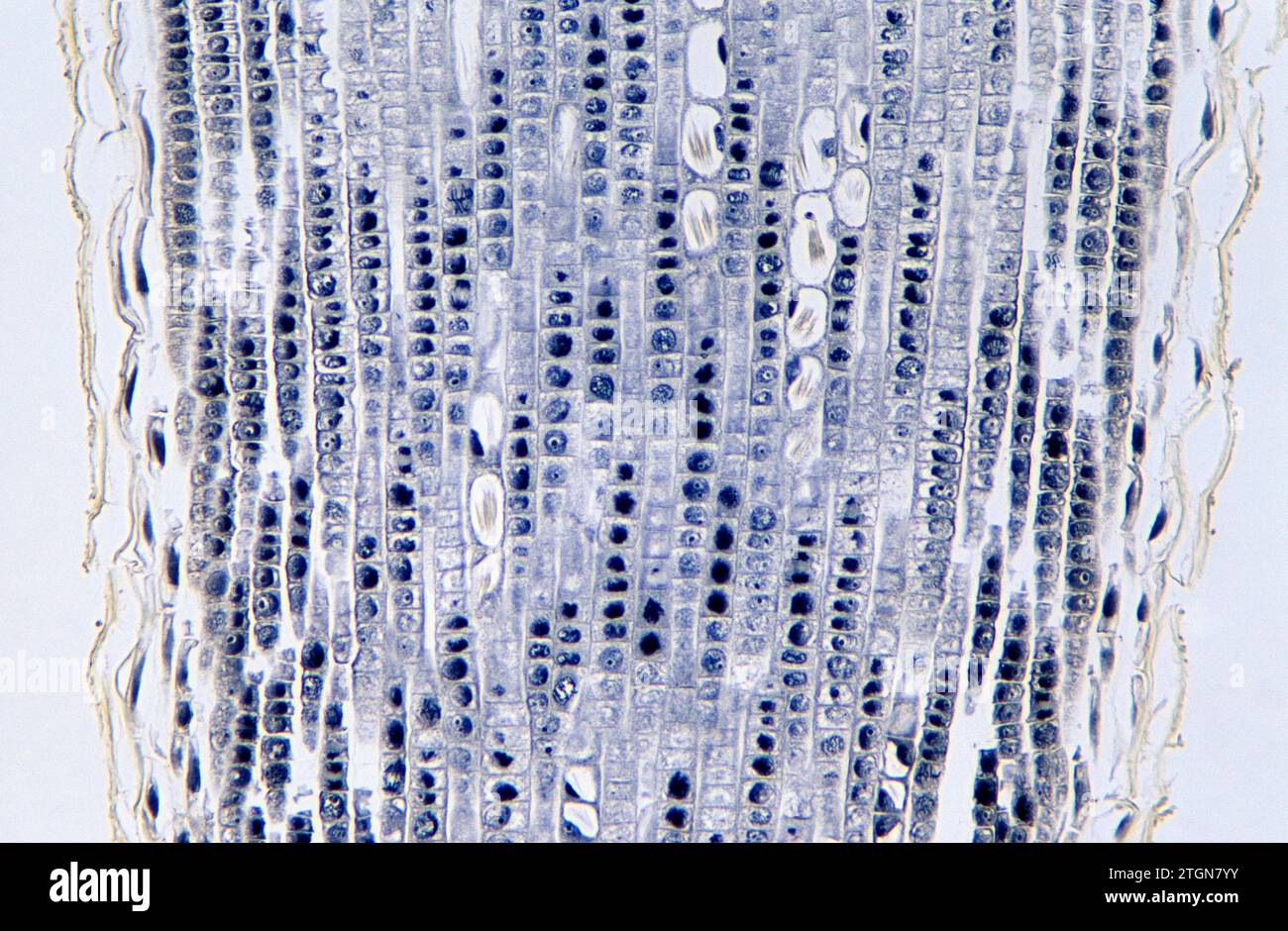 Mitosis stages hi-res stock photography and images - Alamy