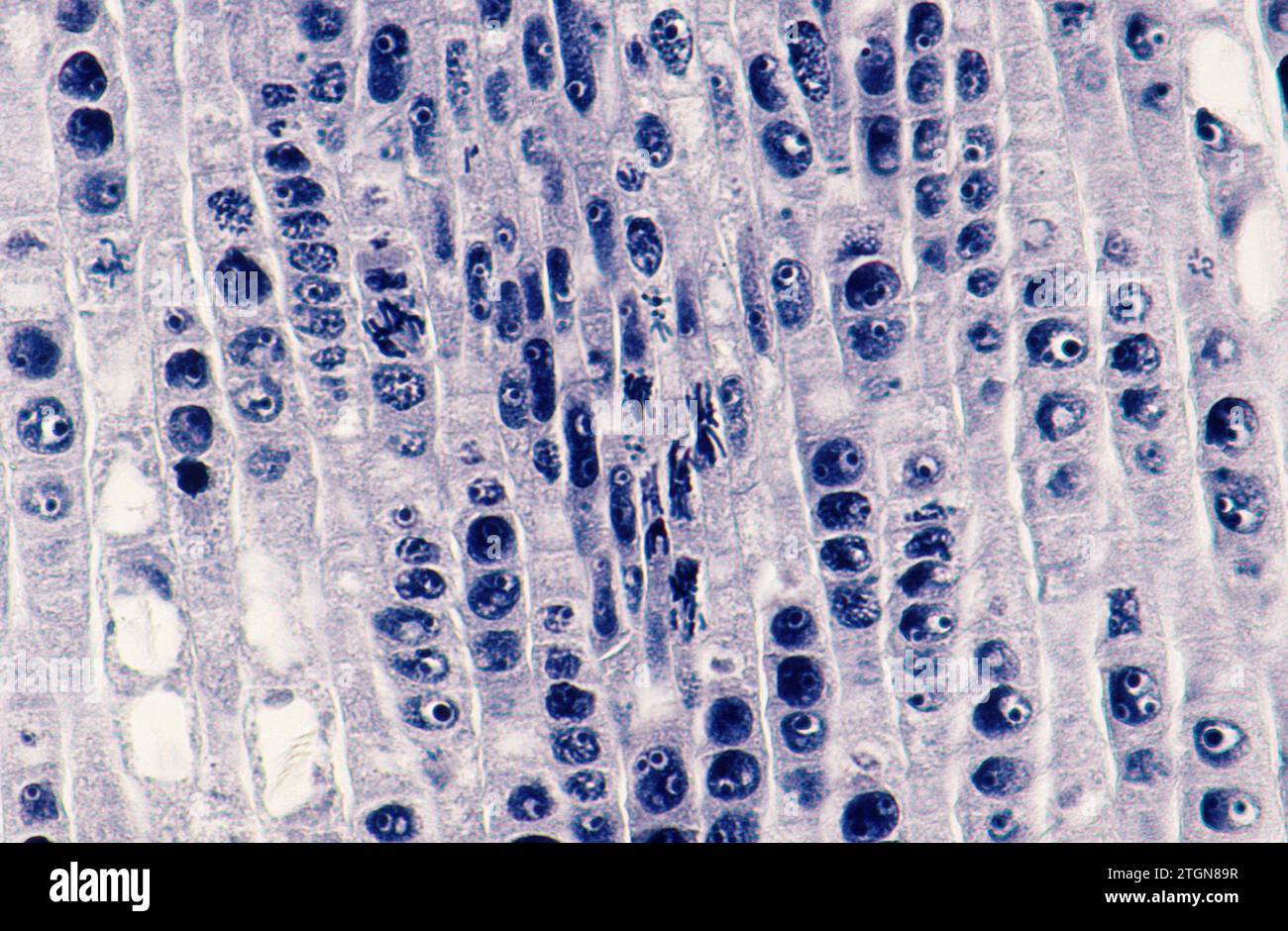 Root apical meristem showing cell divisions (mitosis). Onion root ...