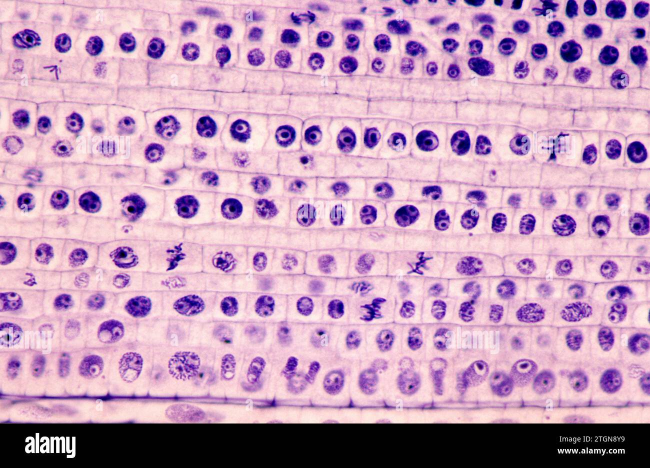 Root apical meristem showing cell divisions (mitosis). Onion root ...