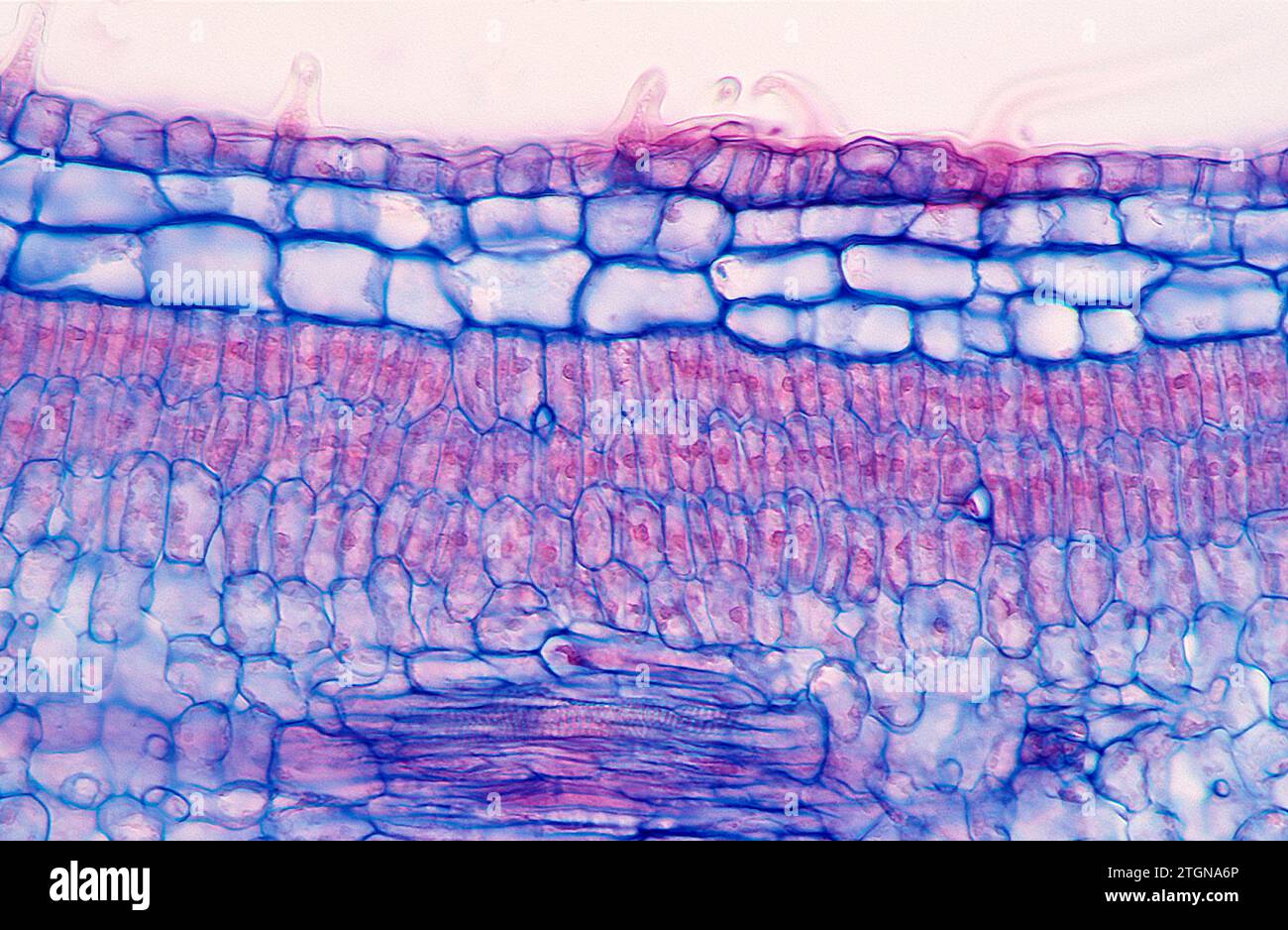 Palisade Parenchyma DICOT LEAF UPPER EPIDERMIS CUTICLE PALISADE