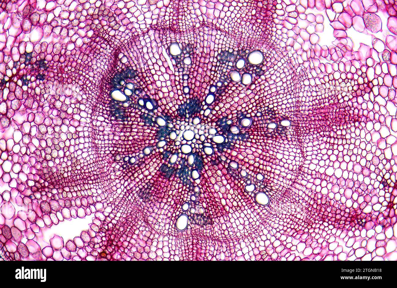 Stem, cross section showing xylem, endodermis and parenchyma ... Stem, cross section showing xylem, endodermis and parenchyma ...