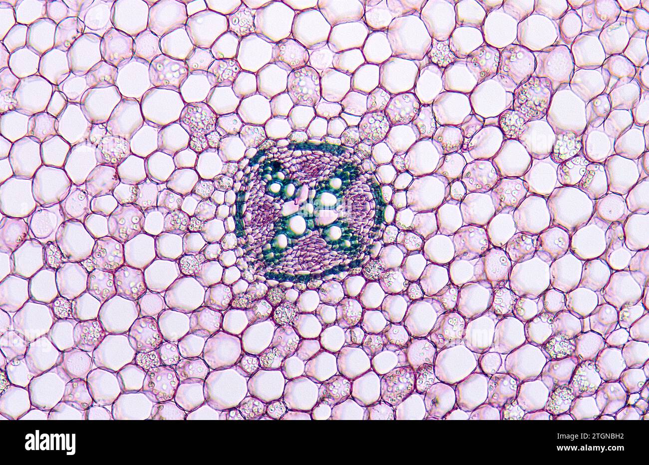 Reserve parenchyma, cross section. Ranunculus root photomicrograph ... Reserve parenchyma, cross section. Ranunculus root photomicrograph ...