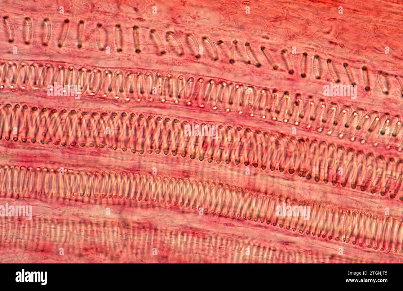 Xylem Longitudinal Section