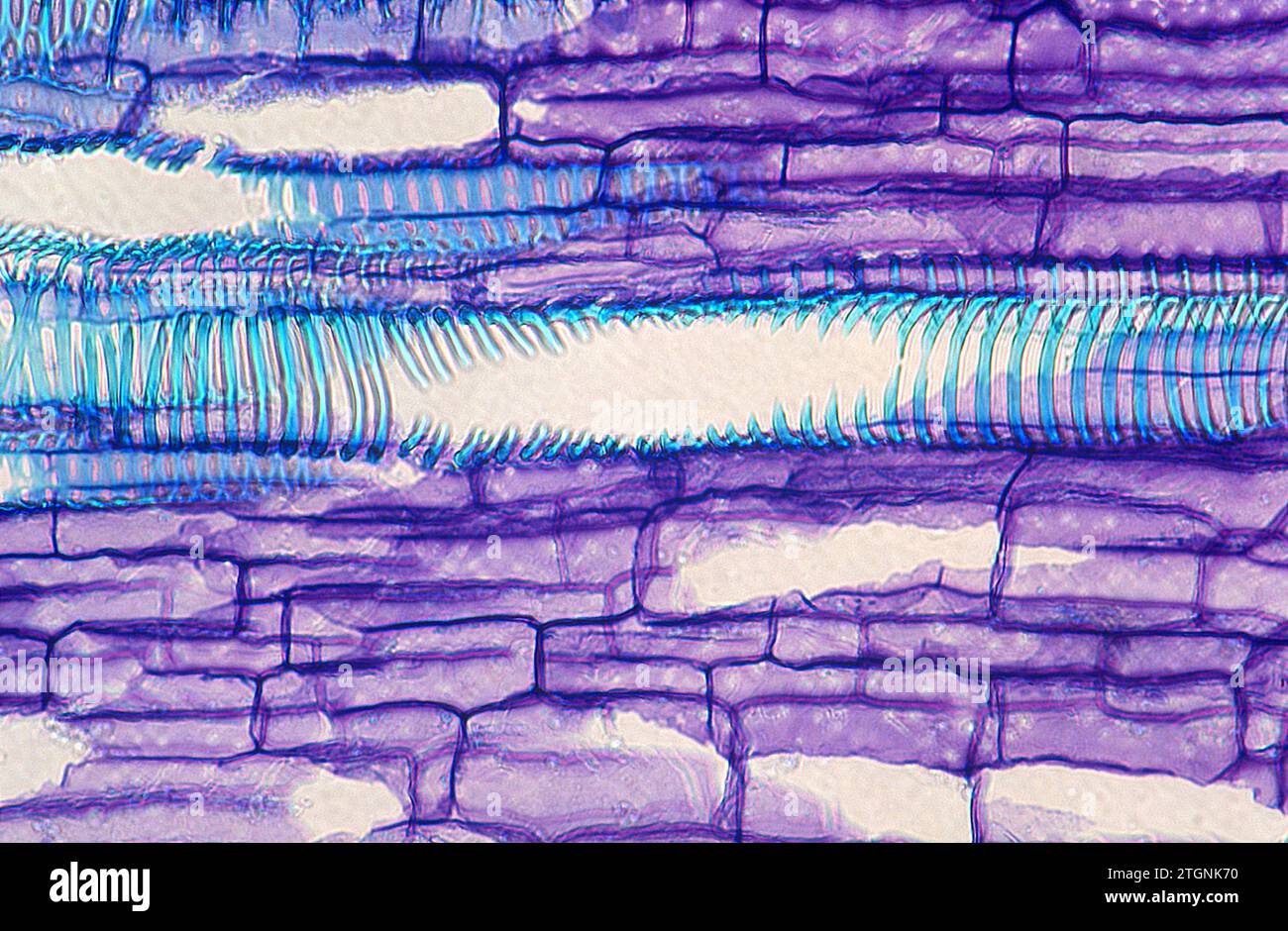 Pumpkin stem longitudinal section showing spiral tracheids (xylem ...