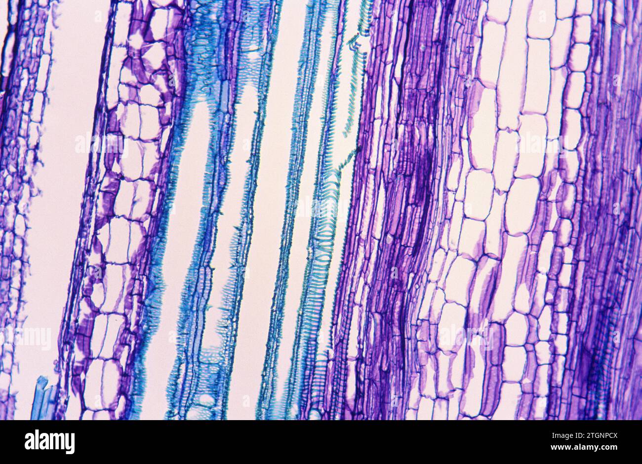 Phloem Longitudinal Section