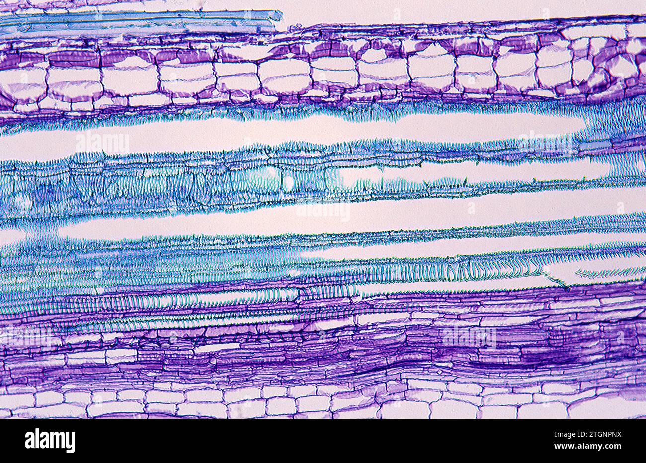 Phloem Longitudinal Section Secondary Phloem