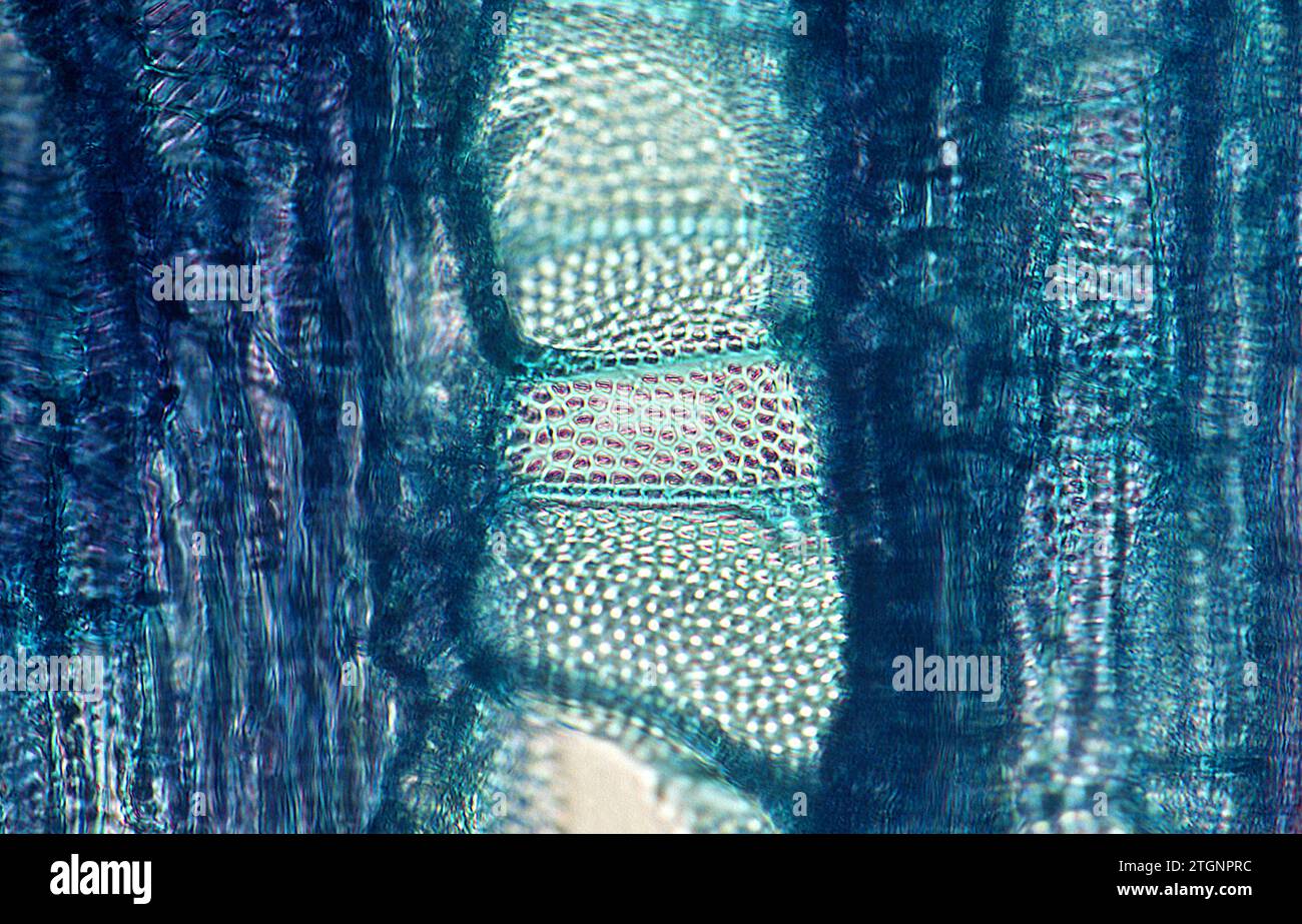 Sieve cells of phloem detail. Photomicrograph Stock Photo - Alamy