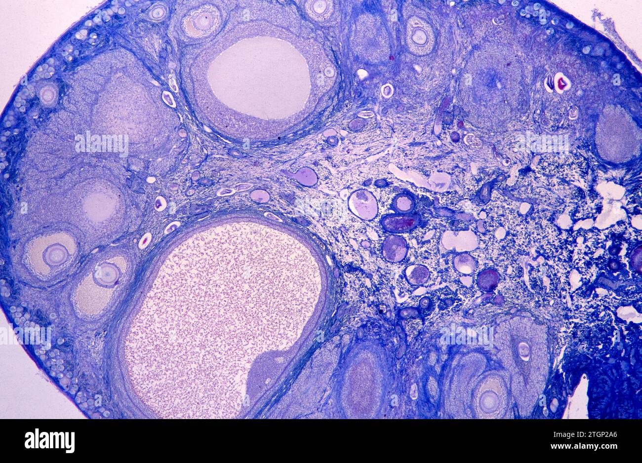 Cat ovari showing folicle and corpus luteum. Photomicrograph Stock ...