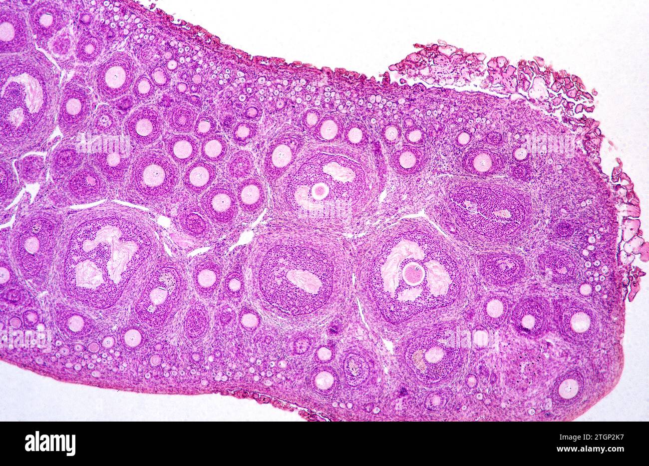 Photomicrograph ovary hi-res stock photography and images - Alamy