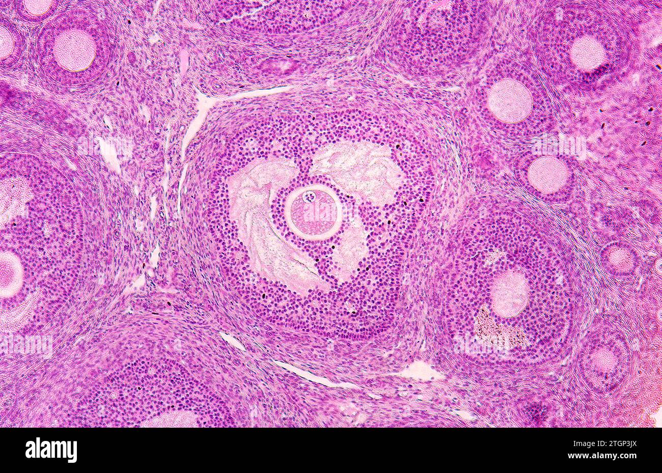 Photomicrograph ovary hi-res stock photography and images - Alamy