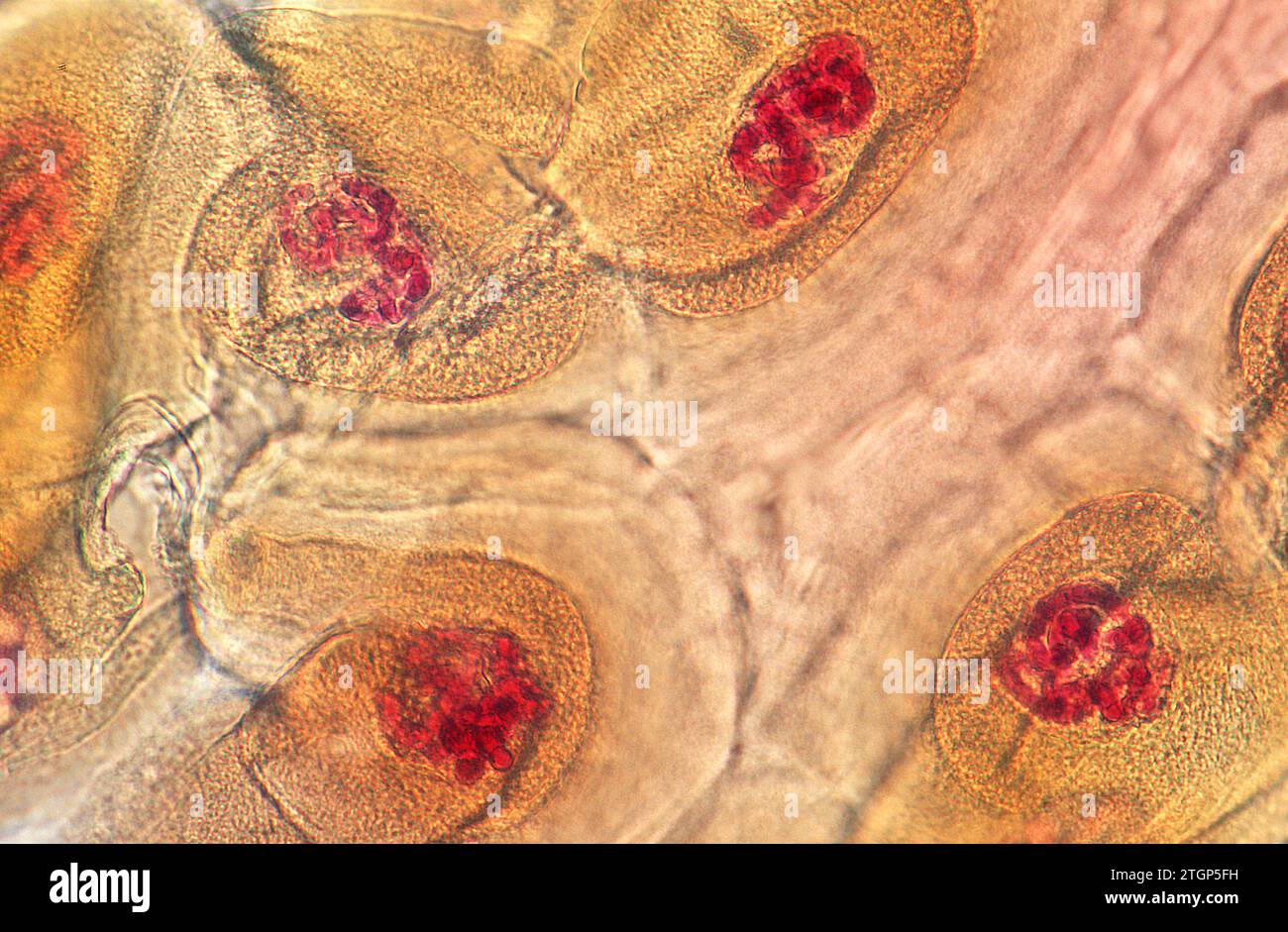 Polytene chromosomes of Chironomus salivary gland cells ...