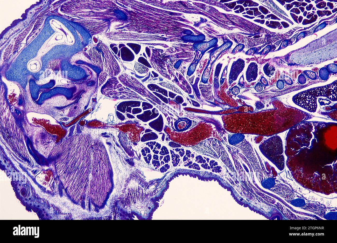 Mouse embryo. Anterior region of the body. Photomicrograph Stock Photo ...