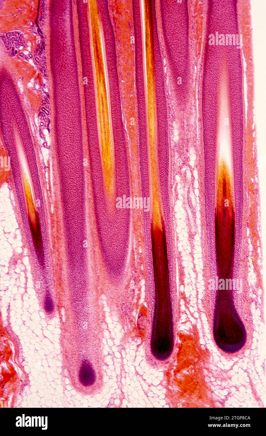 Hair follicles on a human skin. Photomicrograph Stock Photo - Alamy