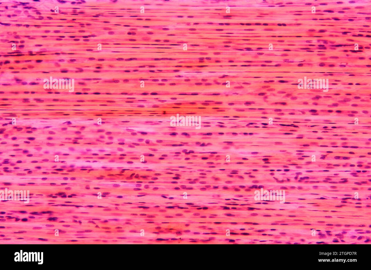 Tejido denso hi-res stock photography and images - Alamy