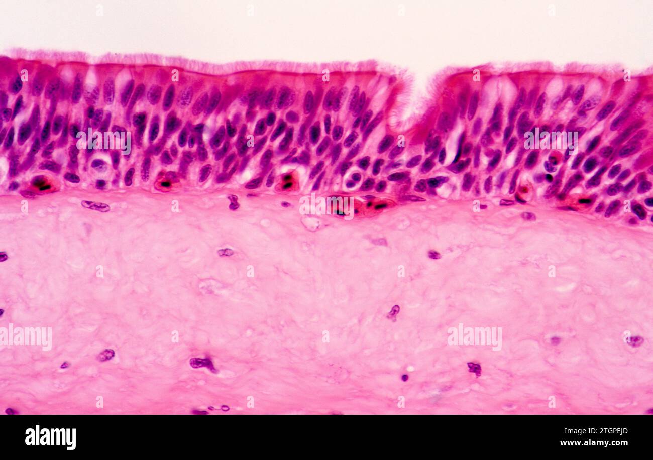 Pseudostratified columnar ciliated epithelium hi-res stock photography ...
