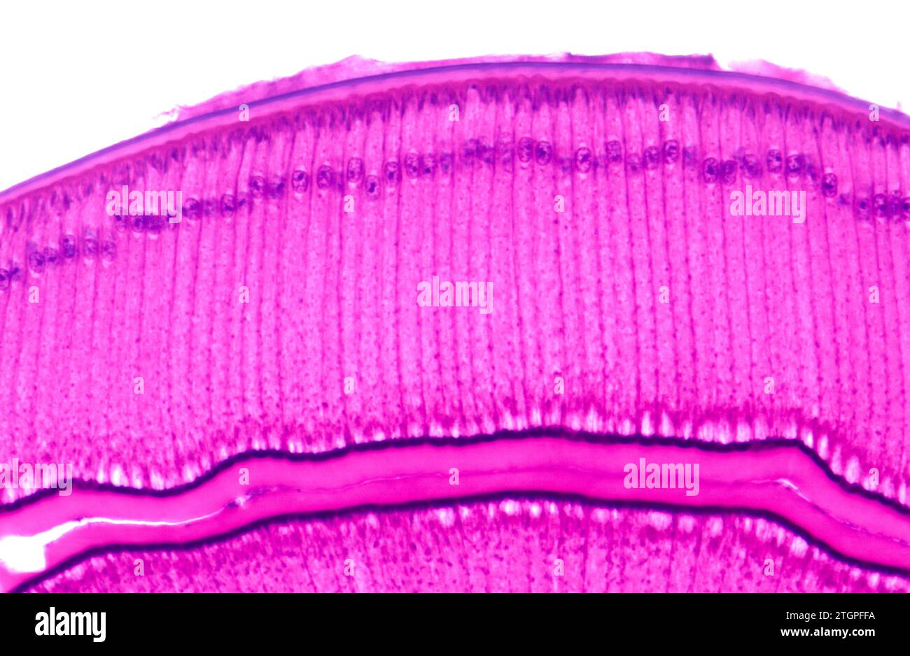 Simple columnar epithelium. Photomicrograph Stock Photo - Alamy