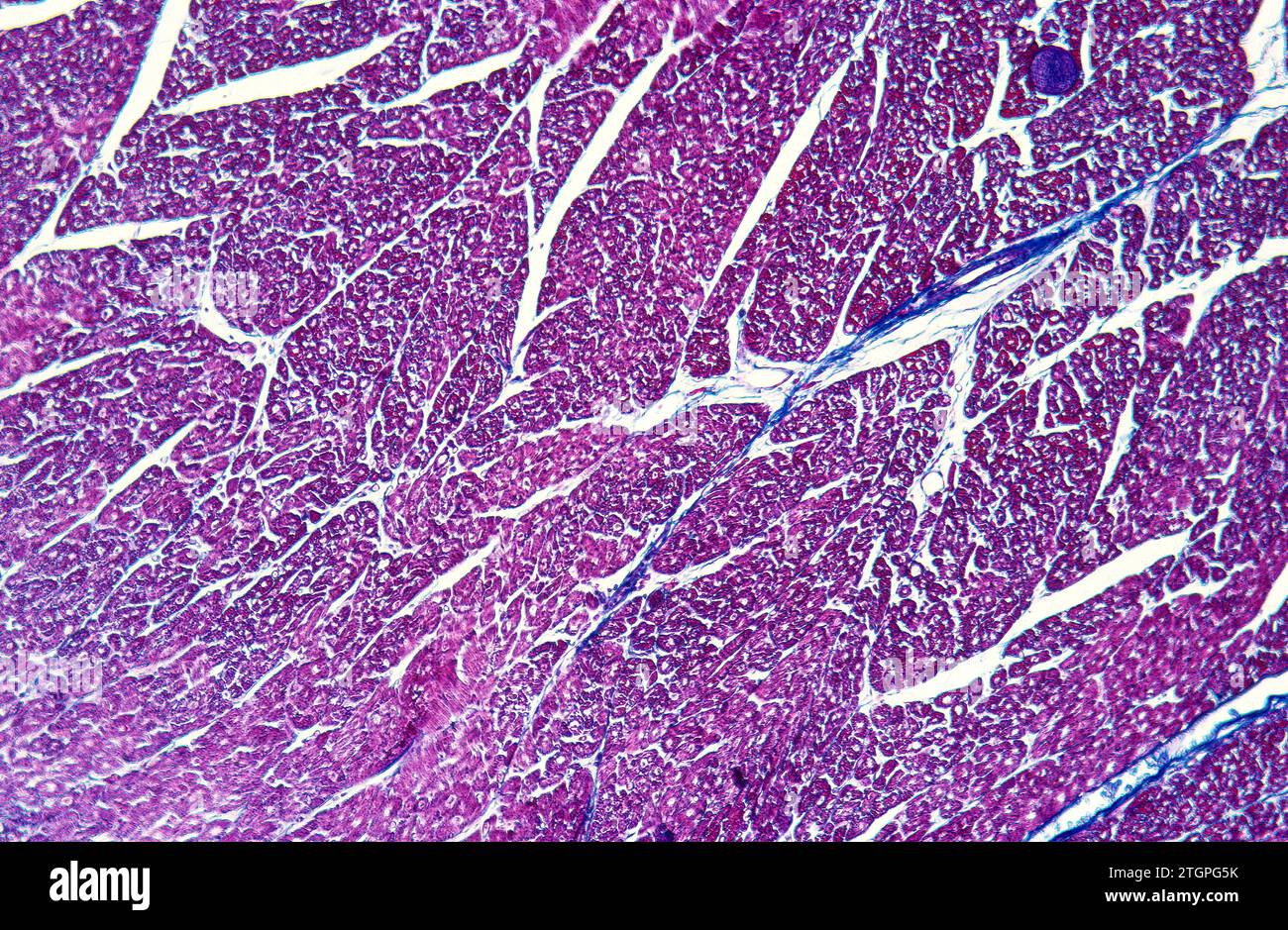 Cardiac muscle hi-res stock photography and images - Alamy