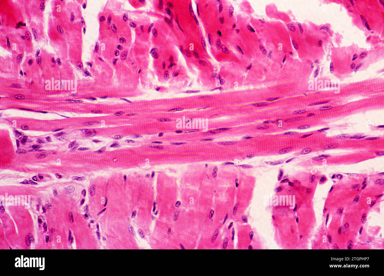 Skeletal muscle, longitudinal section. Photomicrograph Stock Photo - Alamy