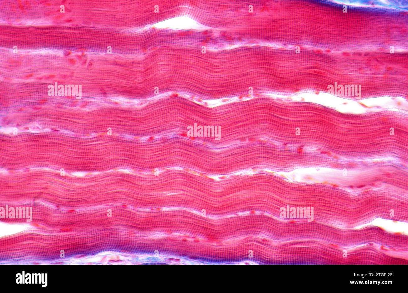 Longitudinal section of skeletal muscle hi-res stock photography and ...