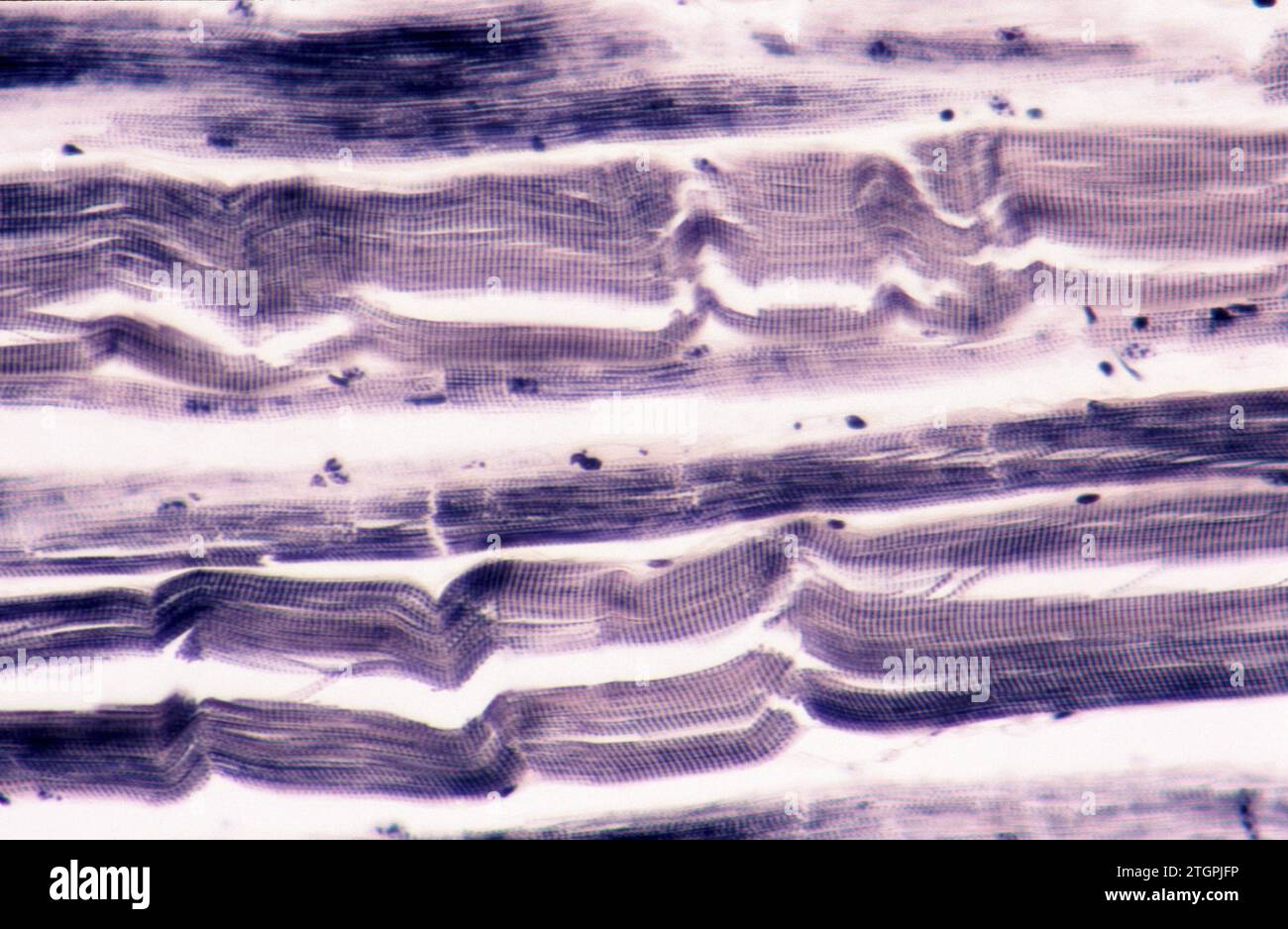 Skeletal muscle, longitudinal section. Photomicrograph Stock Photo - Alamy