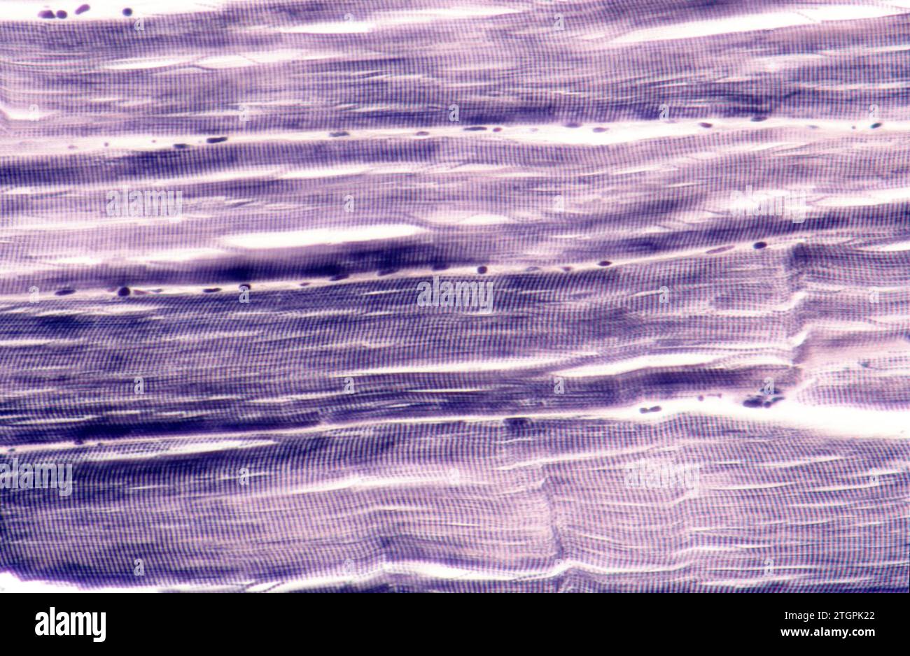 Skeletal muscle, longitudinal section. Photomicrograph Stock Photo - Alamy