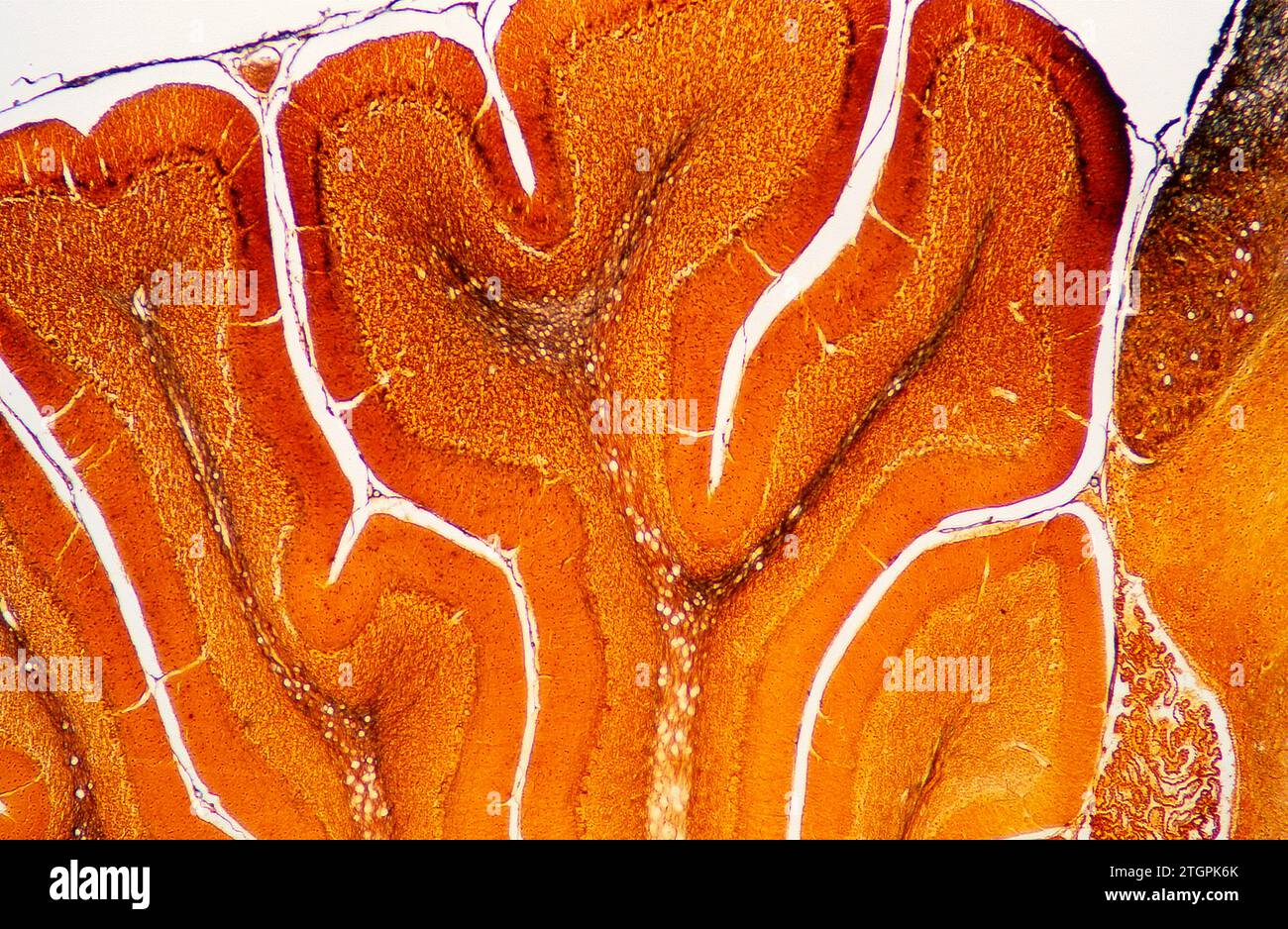 Telencephalon showing brain convolutions in cross section ...