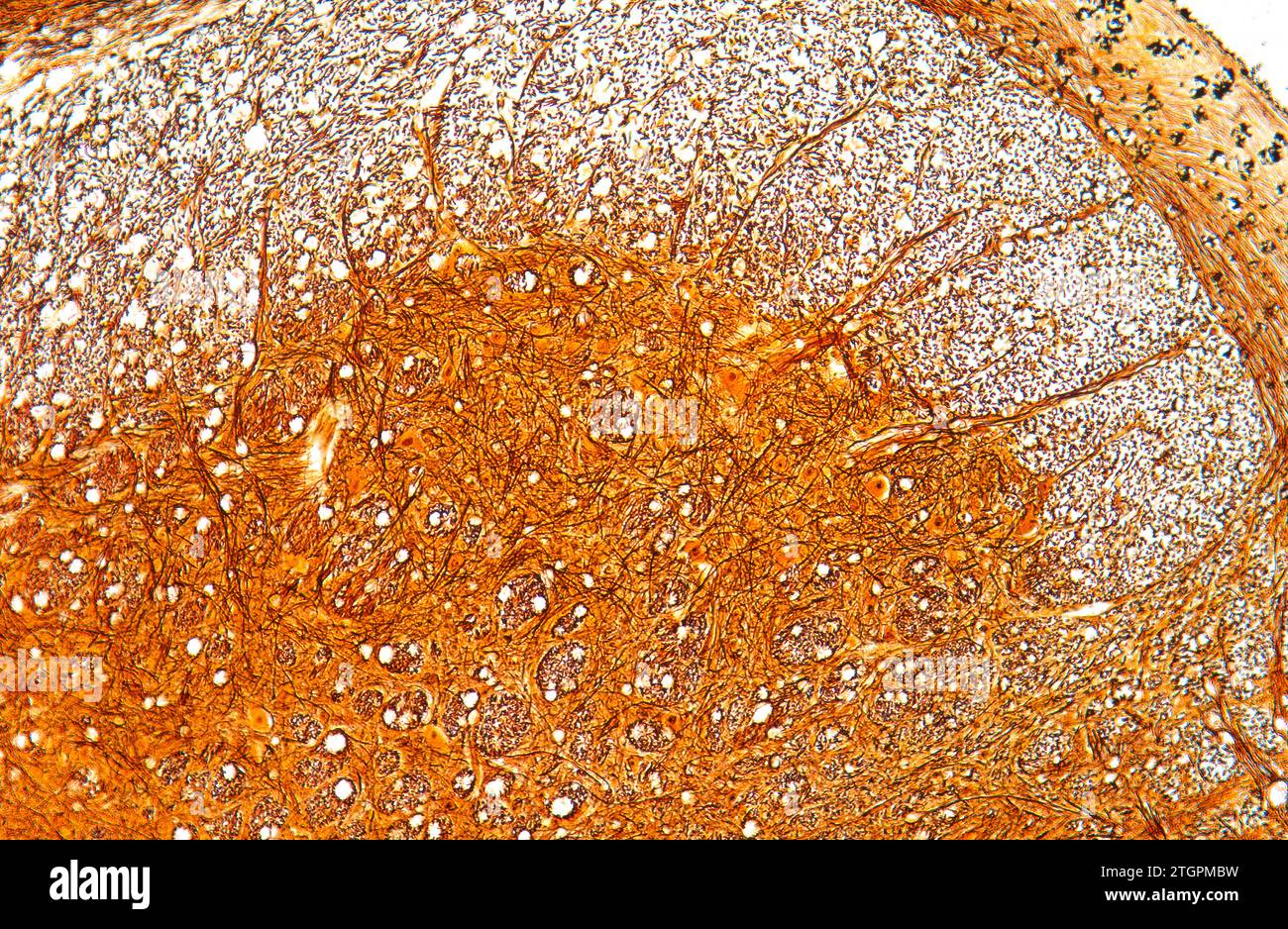 Human cerebelar cortex section. Photomicrograph, Cajal stain Stock ...