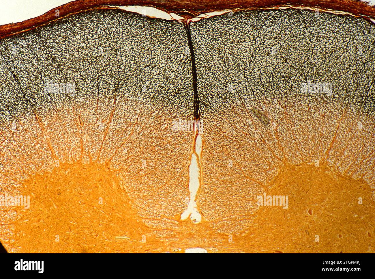 Spinal cord, anterior side showing grey and white matter ...