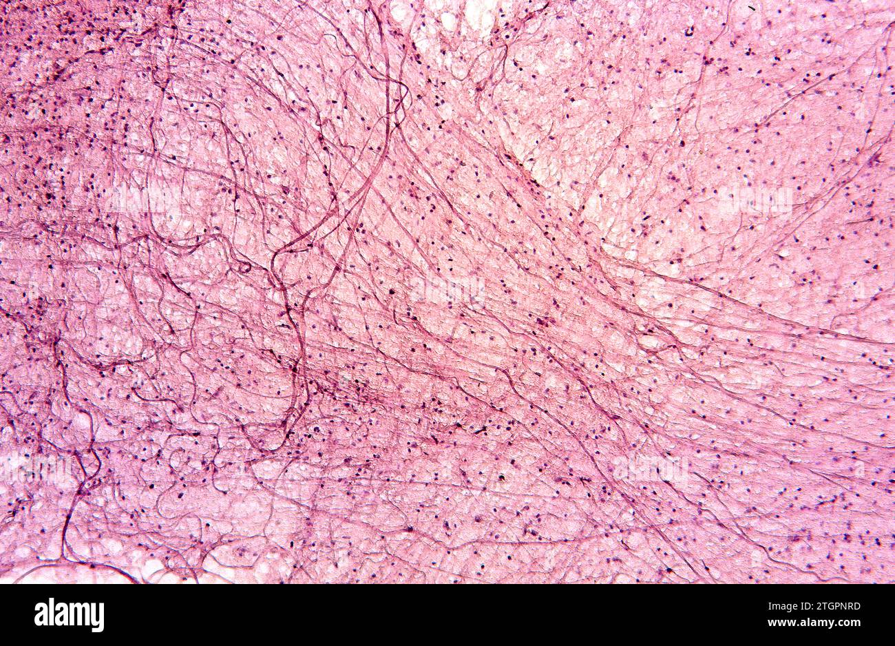 Axons of motor neurons. Photomicrograph Stock Photo - Alamy