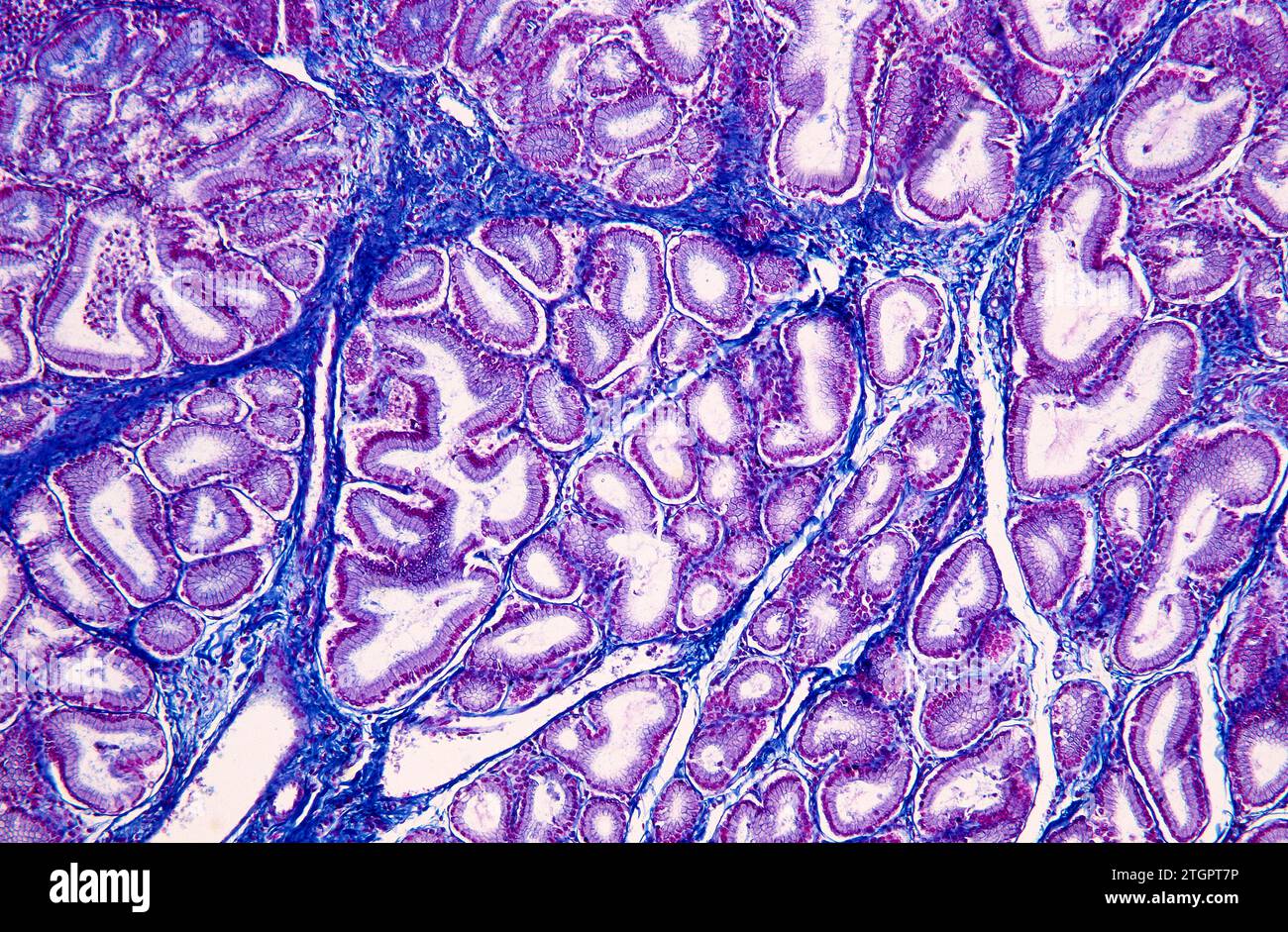 Salivary gland section showing lobules and acini. Photomicrograph Stock ...