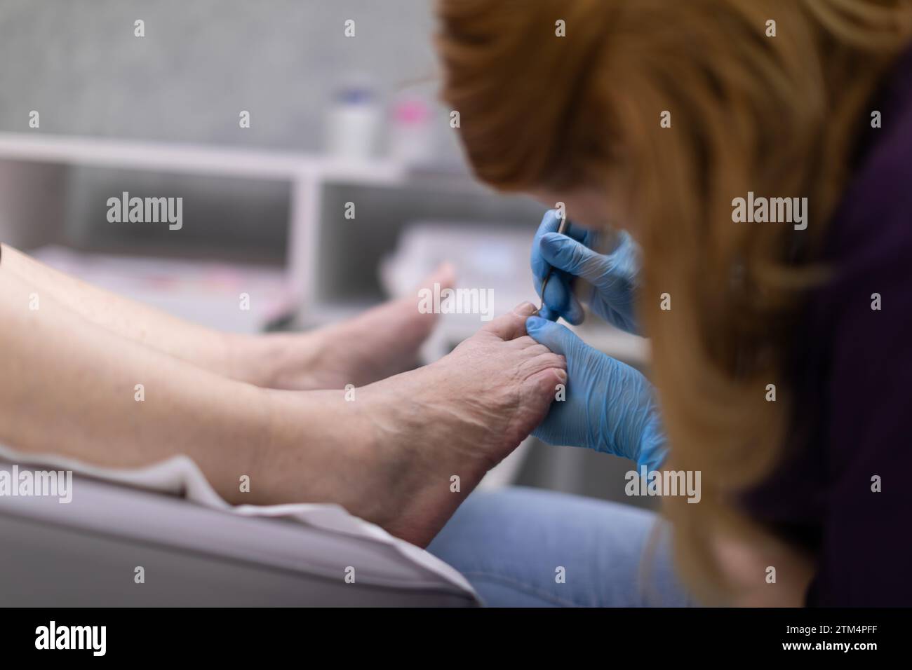 The podiatrist works out the nail plate using specialized tools Stock ...