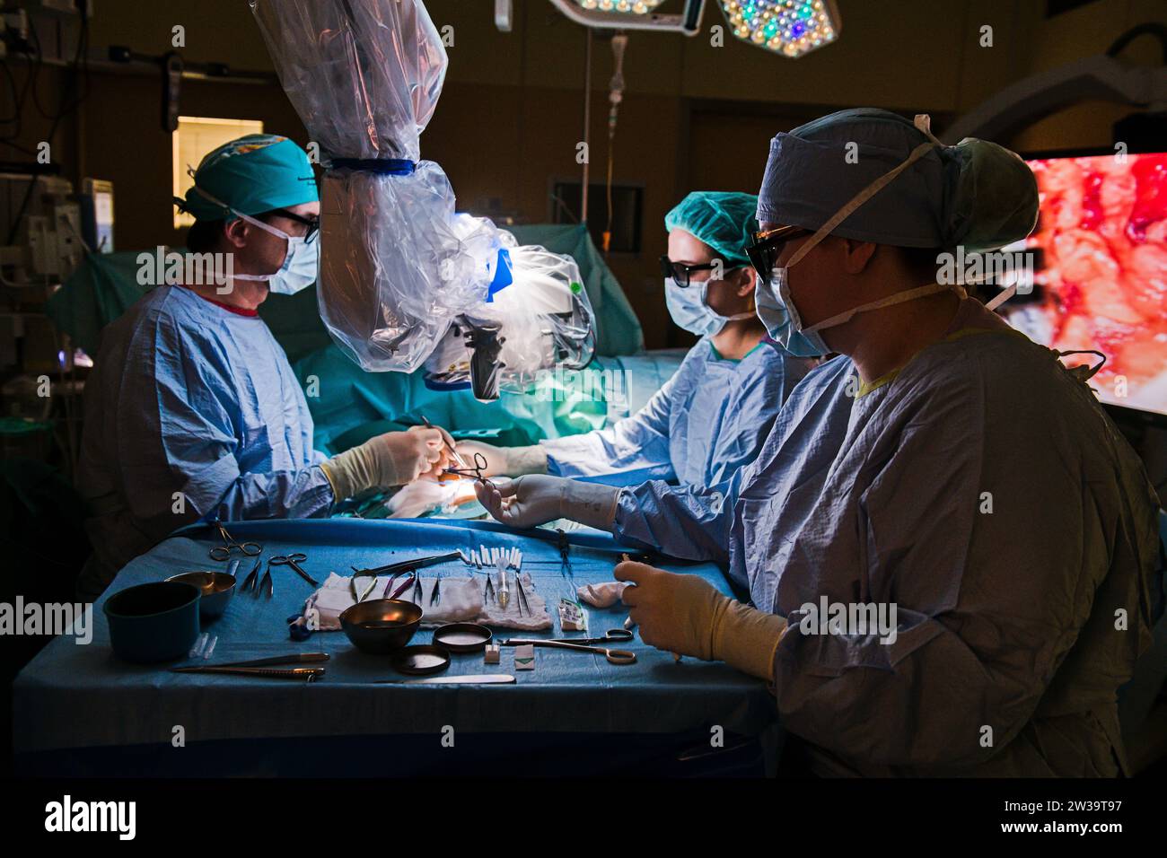 Brno, Czech Republic. 21st Dec, 2023. Lymphatic swelling surgery, a ...