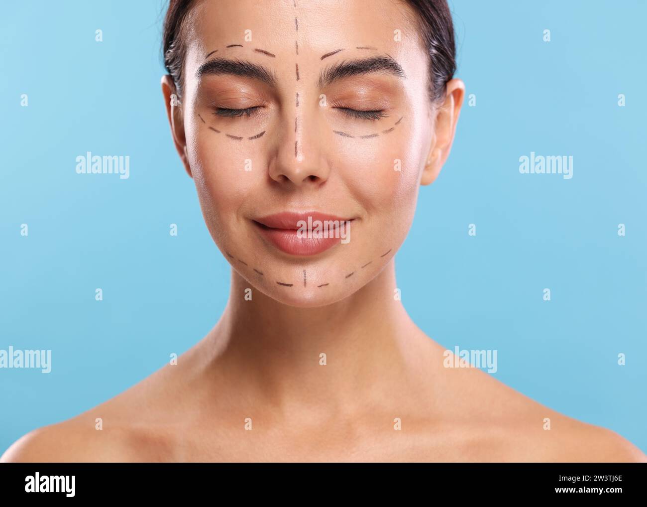 Young woman with marks on face for cosmetic surgery operation against ...