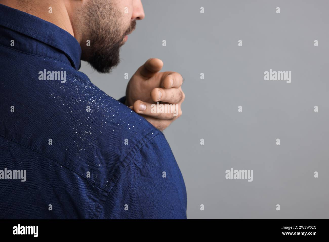 Man brushing dandruff off his shirt on grey background, closeup. Space ...