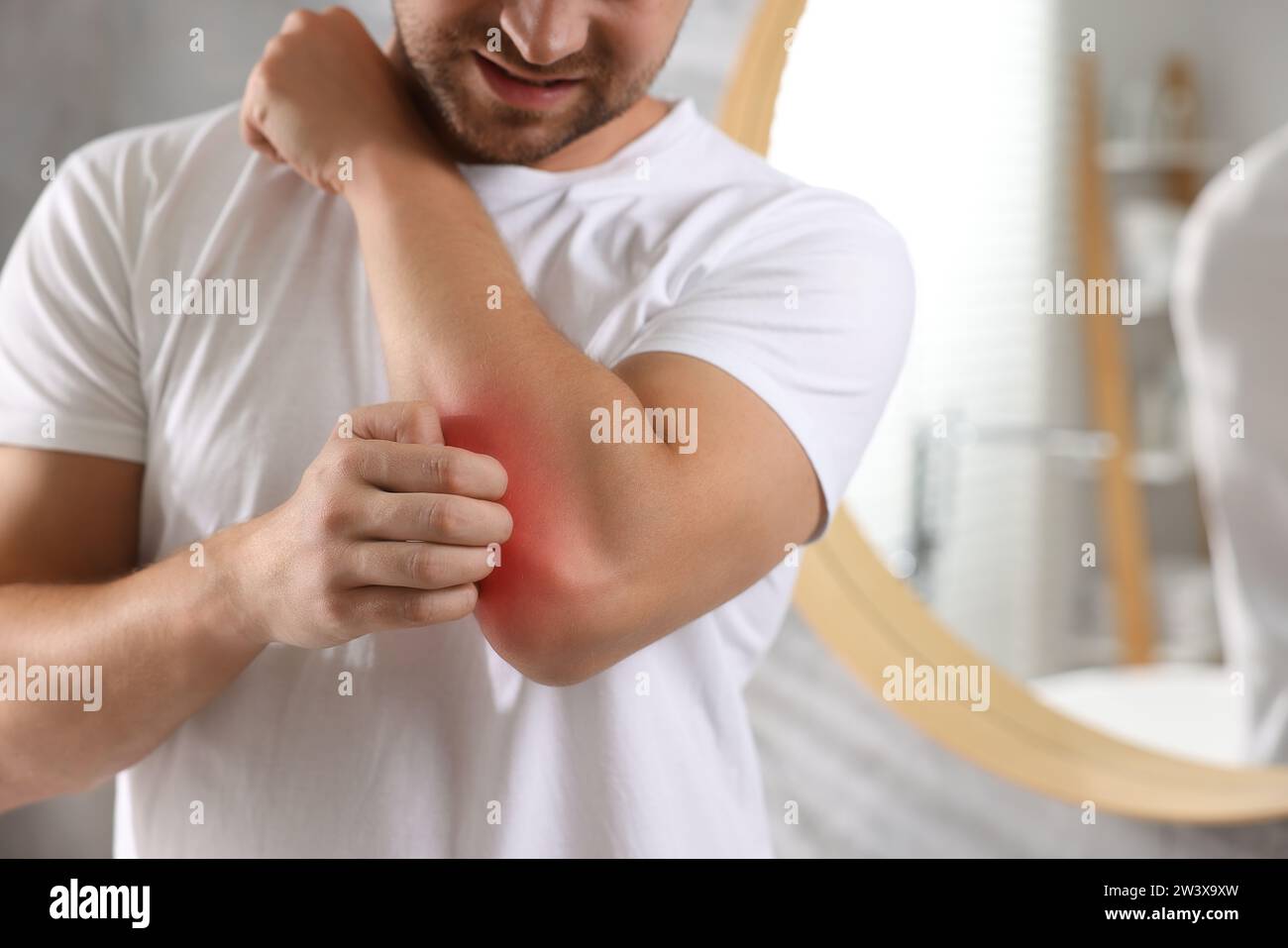 Hands scratching allergic arm suffering hi-res stock photography and ...
