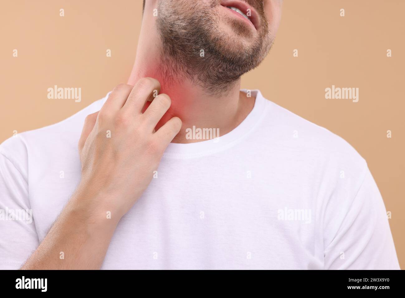 Allergy symptom. Man scratching his neck on light brown background ...