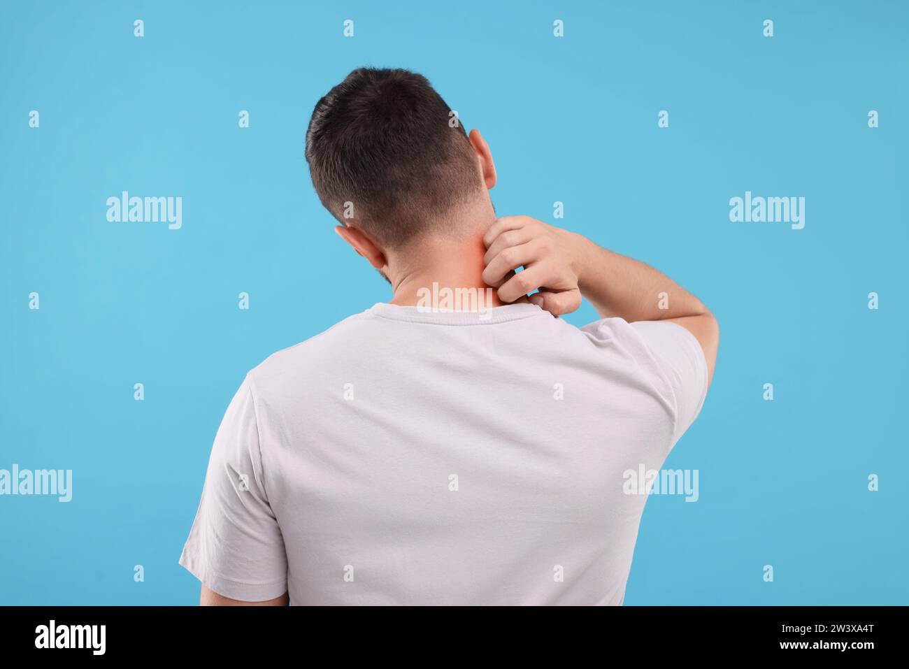 Allergy symptom. Man scratching his neck on light blue background, back ...