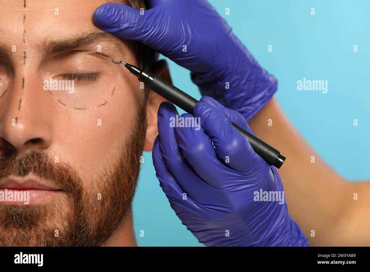 Doctor preparing patient for cosmetic surgery operation on light blue ...