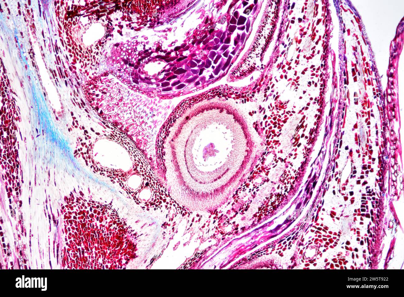 Cono femenino hi-res stock photography and images - Alamy