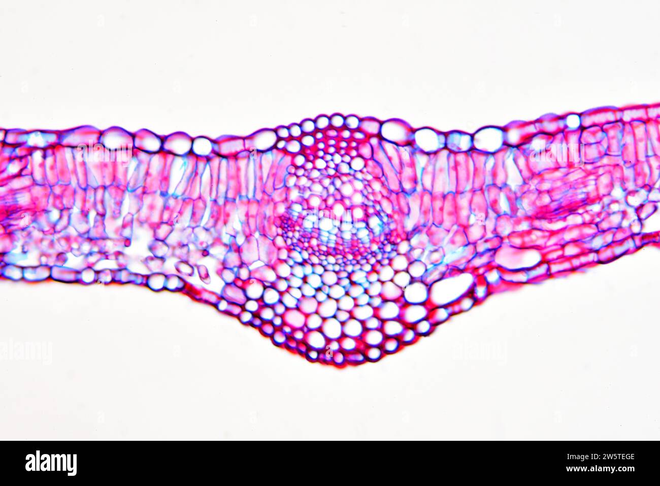 Leaf section of Syringa sp. showing from up to down: cuticle, upper ...