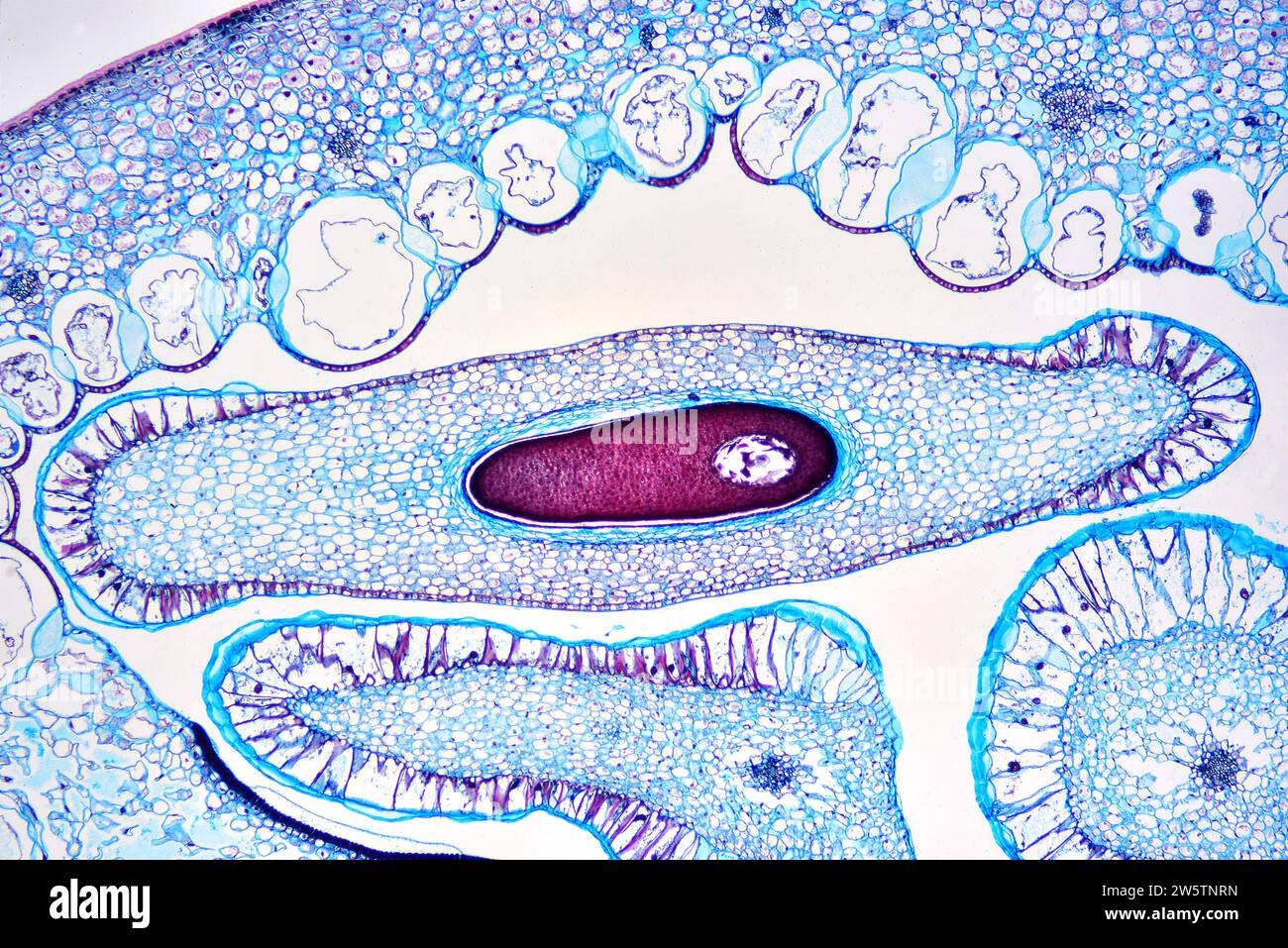 Embryo of pepper (Capsicum annuum). Photomicrograph X20 at 10 cm wide ...